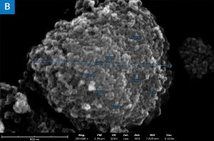 SEM & DLS: Complementary Techniques for Particle Analysis | Nanoscience ...